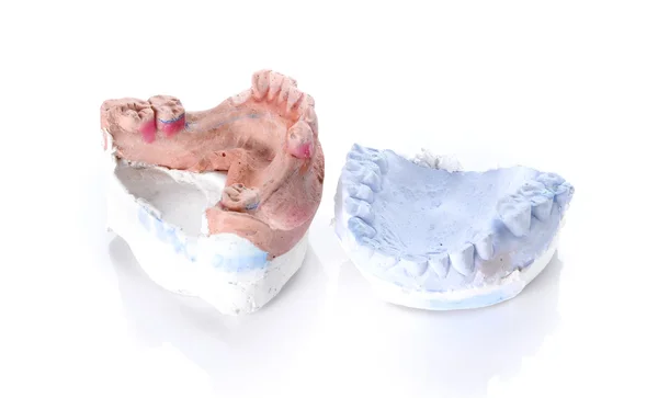 Denture mold,false teeth on white background. Stock Photo by ©poungsaed ...