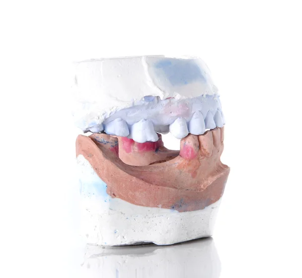 Denture mold,false teeth on white background. Stock Photo by ©poungsaed ...