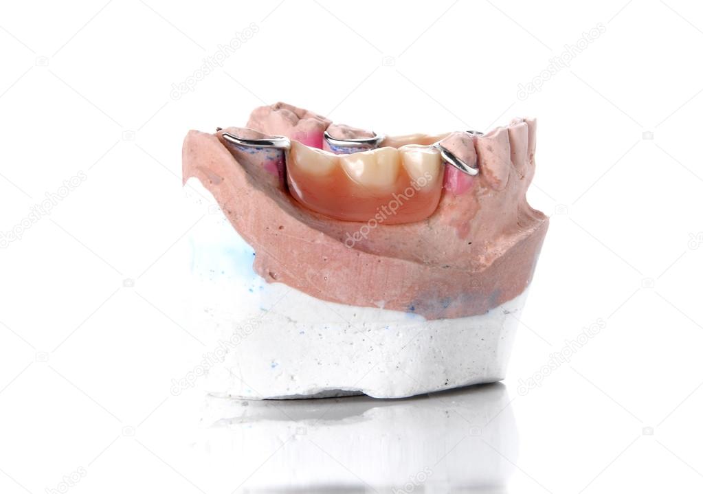 Molde de prótesis, dientes postizos sobre fondo blanco. 2024