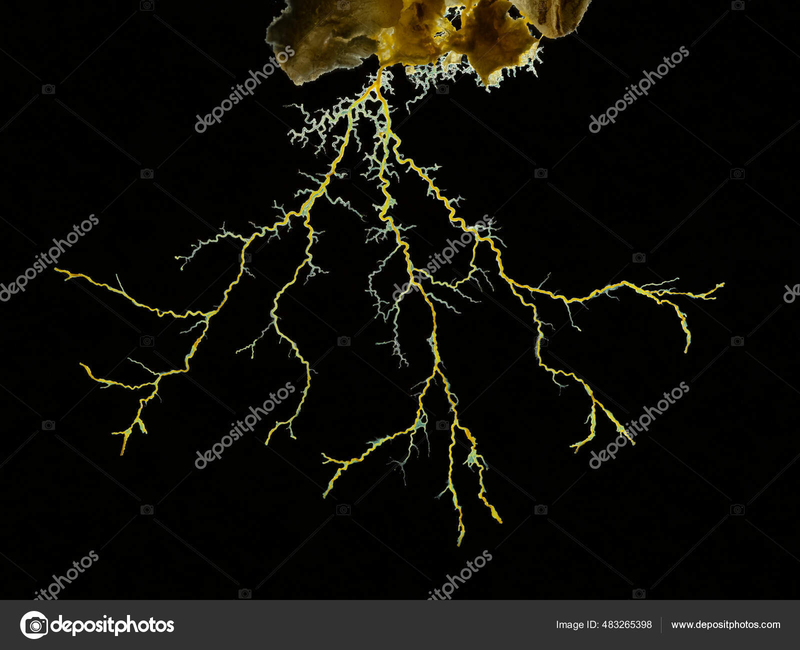 Close Image Yellow Slime Mould Slime Mold Physarum Polycephalum Forming ...