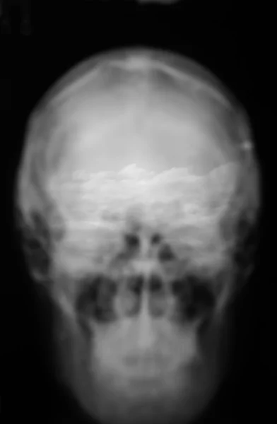 Face mri Stock Photos, Royalty Free Face mri Images | Depositphotos