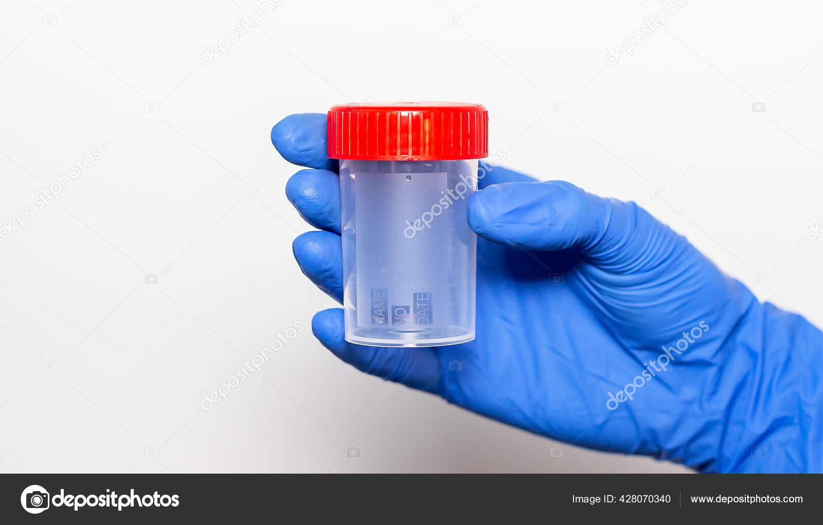 Sperm In Urine Sample