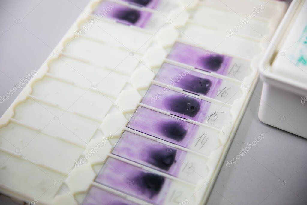 Frotis De Sangre Para Calcular La Fórmula De Glóbulos Blancos Equipo