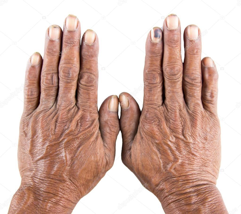 White Person Hand