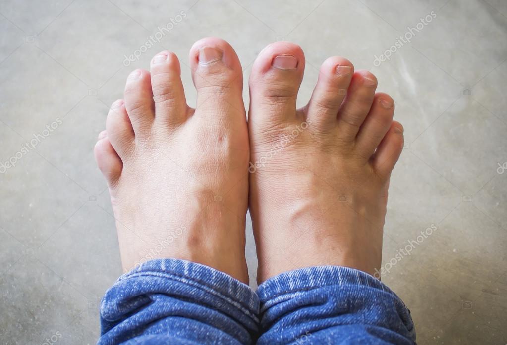 Short toes Stock Photo by ©kamontad999 76180779