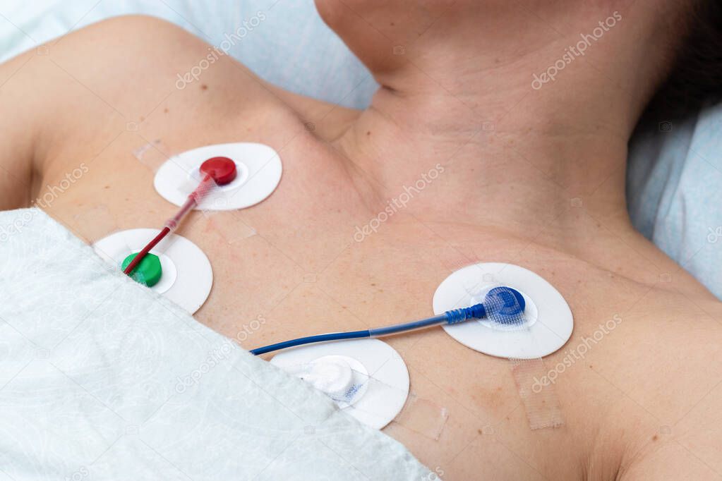Comprobación de cardiopatías con monitor Holter portátil. Examen médico ...