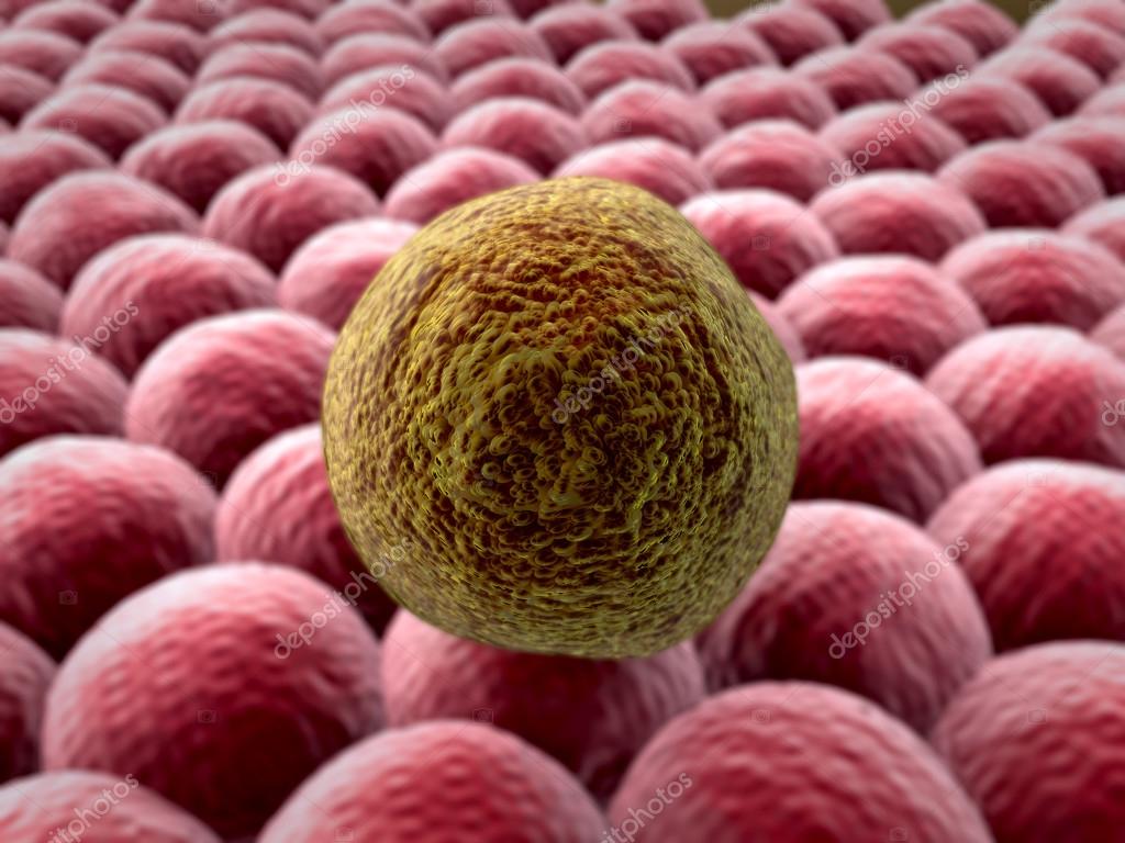 Cancer cell under microscope Stock Photo by ©Ugreen 94226086