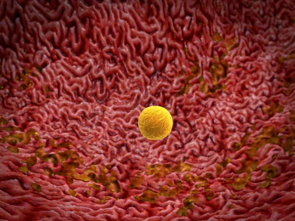 Fat cell in the blood — Stock Photo © Ugreen #130390848