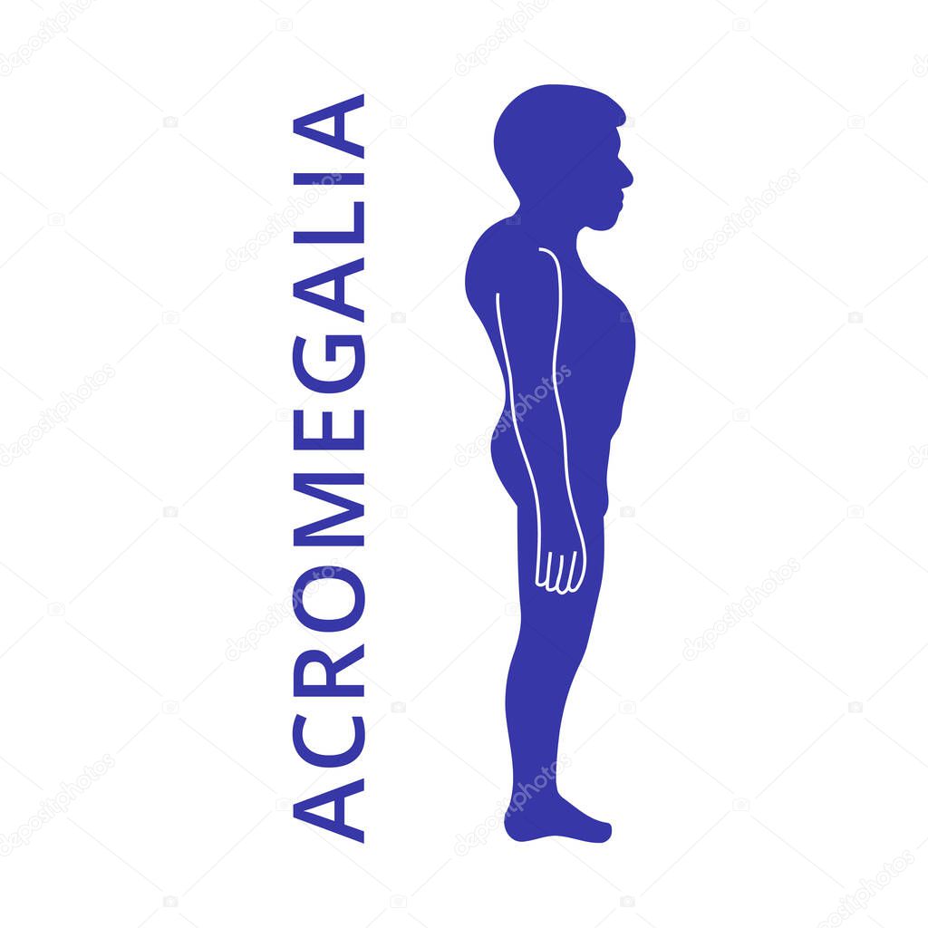 Acromegalia, acromegalia. Enfermedad neuroendocrina. Enfermedad de la ...