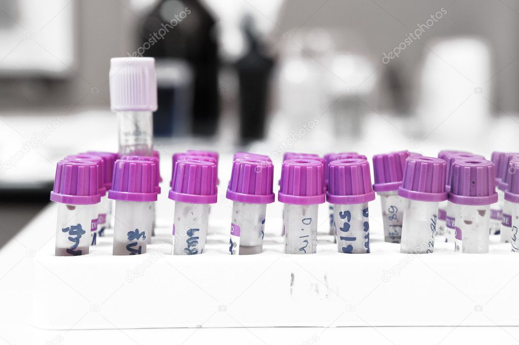 Blood testing in laboratory Stock Photo by ©nimon_t 107215774
