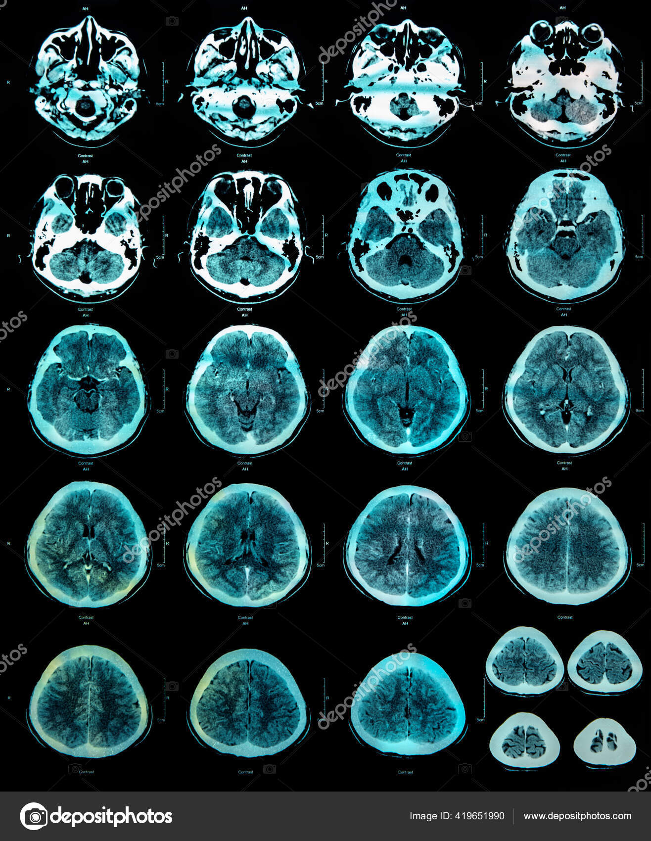 Mri Brain Color