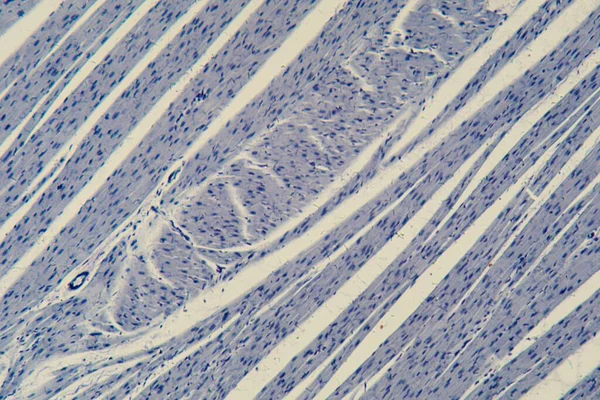 Section of a human cardiac muscle under the microscope. - Stock Image ...