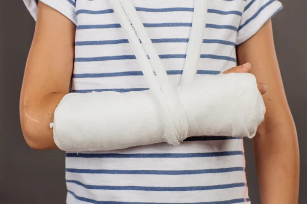 Close-up of a broken arm in a cast on striped shirt background Stock ...