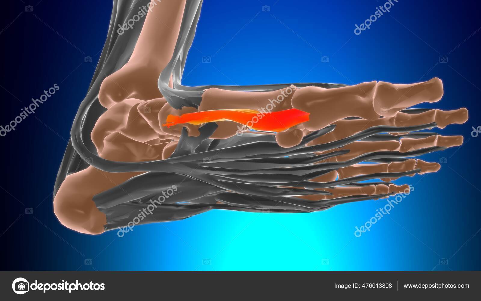 Flexor Hallucis Brevis Pain