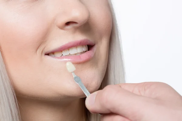 Check veneer of tooth crown — Stock Photo © StudioaMagica #116633126