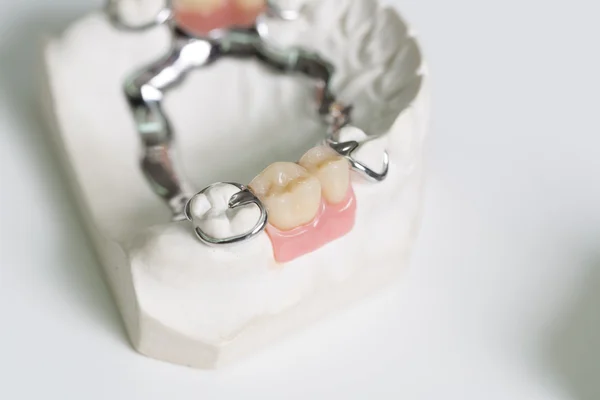 Prosthesis saddle Stock Photos, Royalty Free Prosthesis saddle Images ...