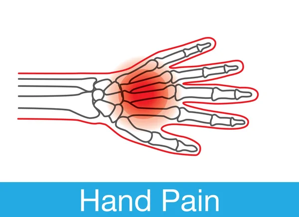 Wrist hand pain Vector Art Stock Images | Depositphotos