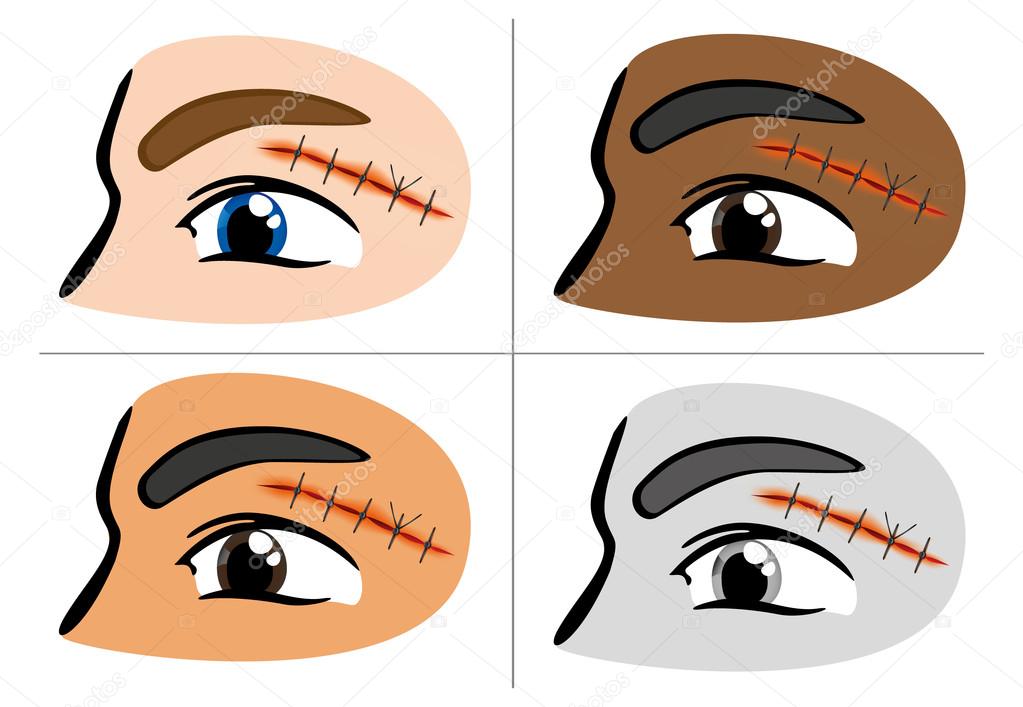 Illustration of a receiving first aid, injury or cut and sutured face ...