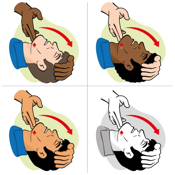 Reanimación de primeros auxilios (RCP), limpieza de la respiración ...