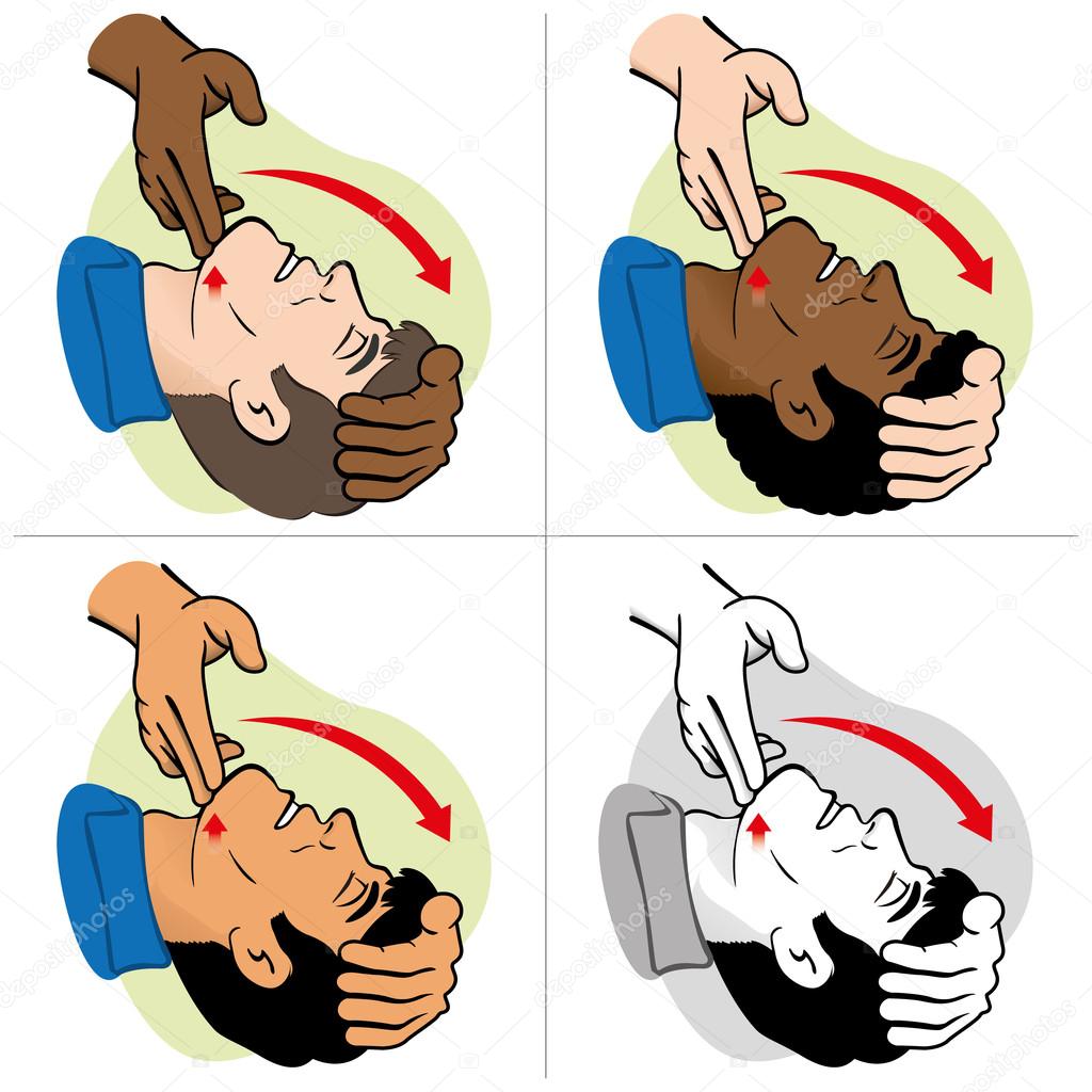 Reanimación de primeros auxilios (RCP), limpieza de la respiración ...