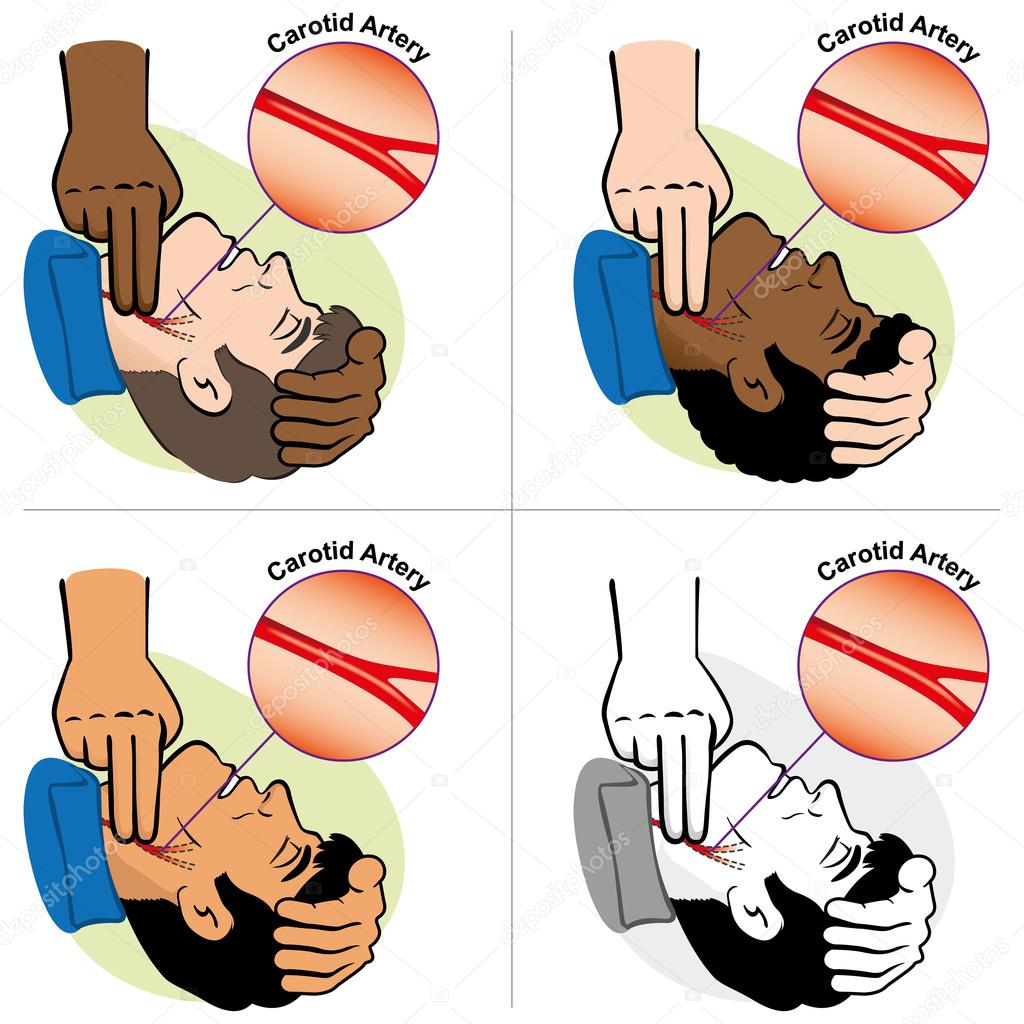 Carotid Pulse Clipart