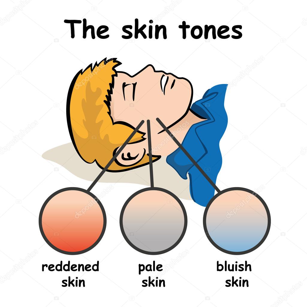 First Aid symptoms, skin tones. Ideal for catalogs, informative and ...