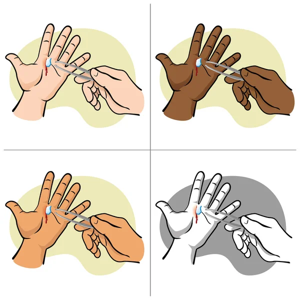 Illustration of a human hand with fingers bunched with bandages, ethnic ...