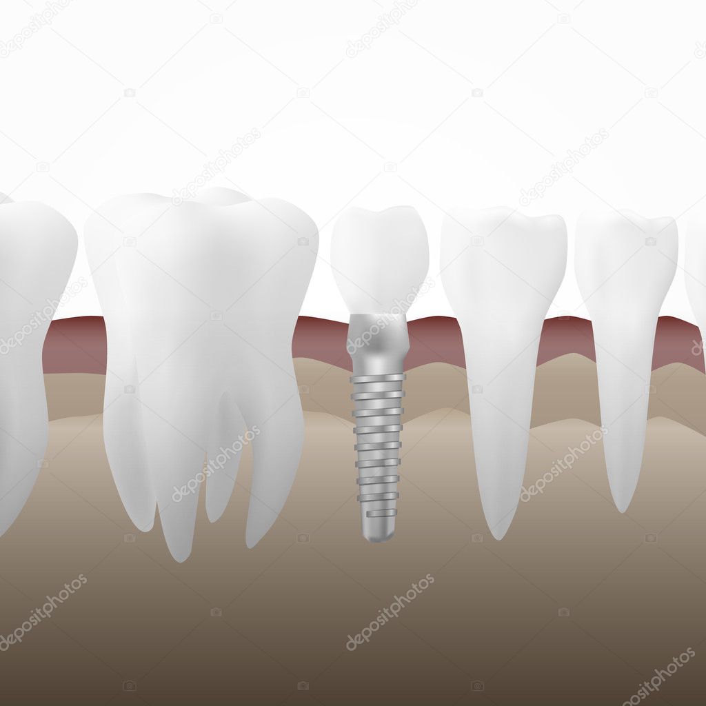 Set of tree tooth — Stock Vector © prahprah #109827430