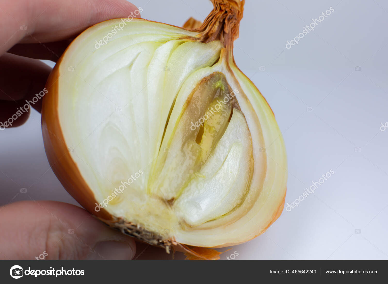 Spoiled Rotten Onion Disease Vegetable Illness Close — Stock Photo ...