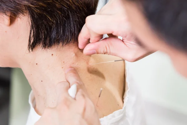 Acupuncturist pricking needle into skin, with shallow depth of field ...