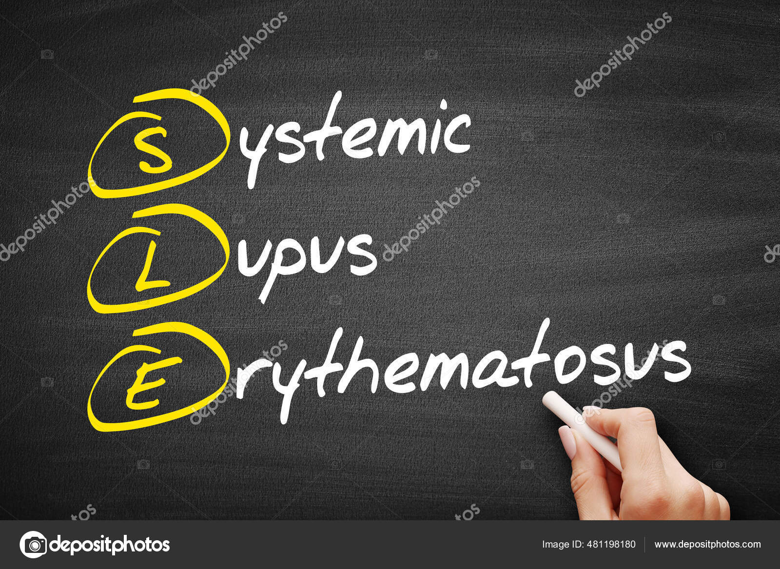 Sle Systemic Lupus Erythematosus Acronym Concept Blackboard Stock Photo ...