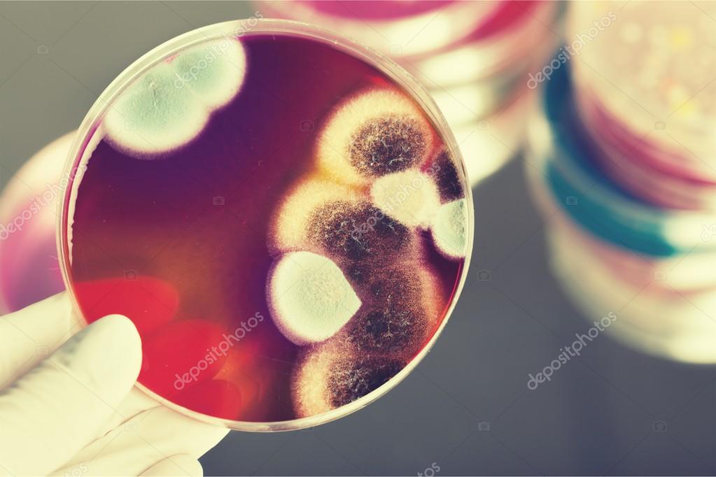 Microbiology laboratory test in scientist hand Stock Photo by ...