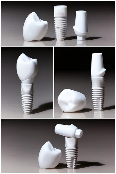 Implants — Stock Photo © Oleg.0 #82457280