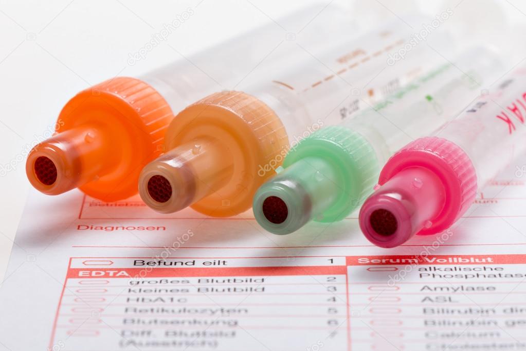 Blood test, blood samples on a laboratory form — Stock Photo ...