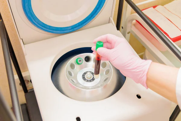 Blood centrifuge Stock Photos, Royalty Free Blood centrifuge Images ...