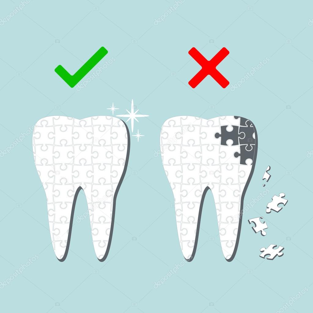 Diente enfermo y sano. Infografías . Vector de stock #95460130 de ©flovie