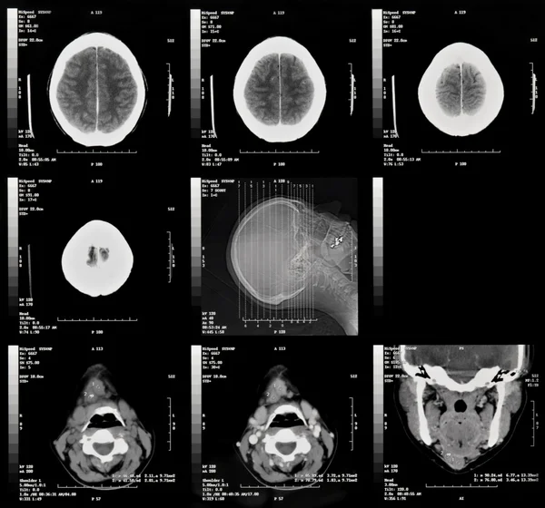 Brain CT with Scout — Stock Photo © Lawcain #67906511