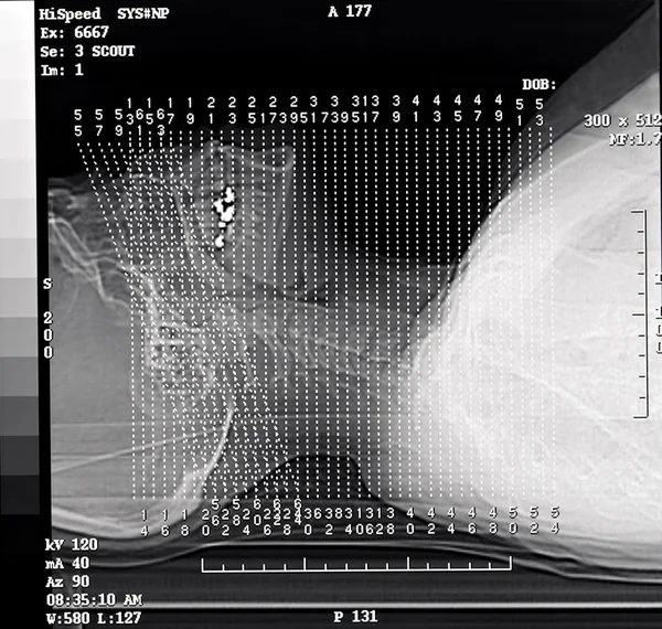 Radiograph Stock Photos, Royalty Free Radiograph Images | Depositphotos