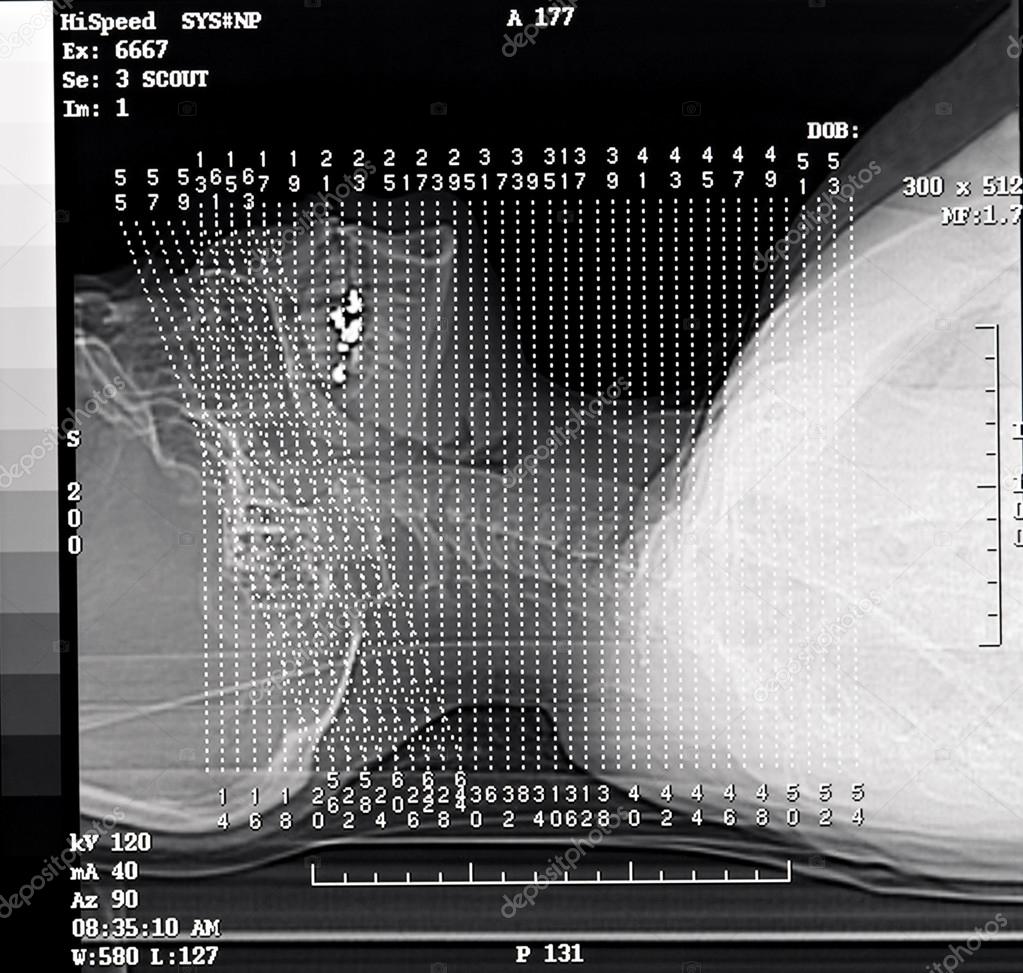 CT Scan Scout — Stock Photo © Lawcain #68643547