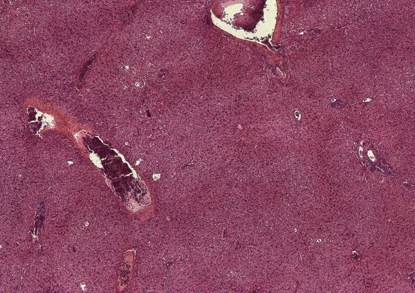 Meninges Stock Photos, Royalty Free Meninges Images | Depositphotos