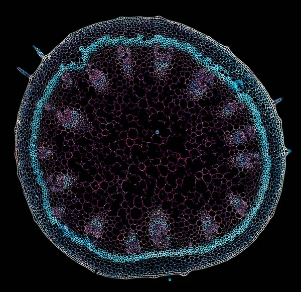 Hairy cell Stock Photos, Royalty Free Hairy cell Images | Depositphotos