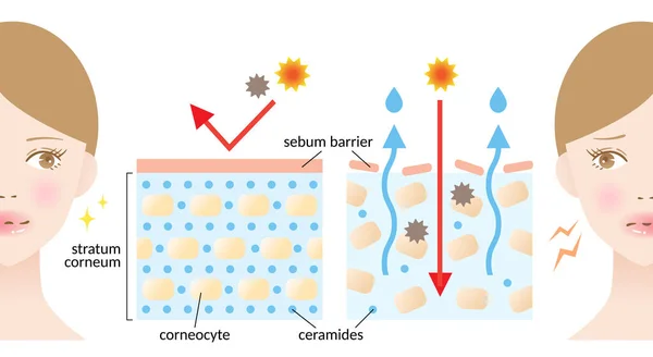 1,813 ilustraciones de stock de Piel seca | Depositphotos