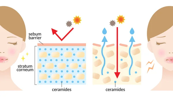 100,000 Ceramide Vector Images | Depositphotos