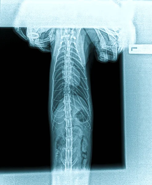 Cat x ray Images - Search Images on Everypixel