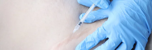 Arm injection Stock Photos, Royalty Free Arm injection Images ...