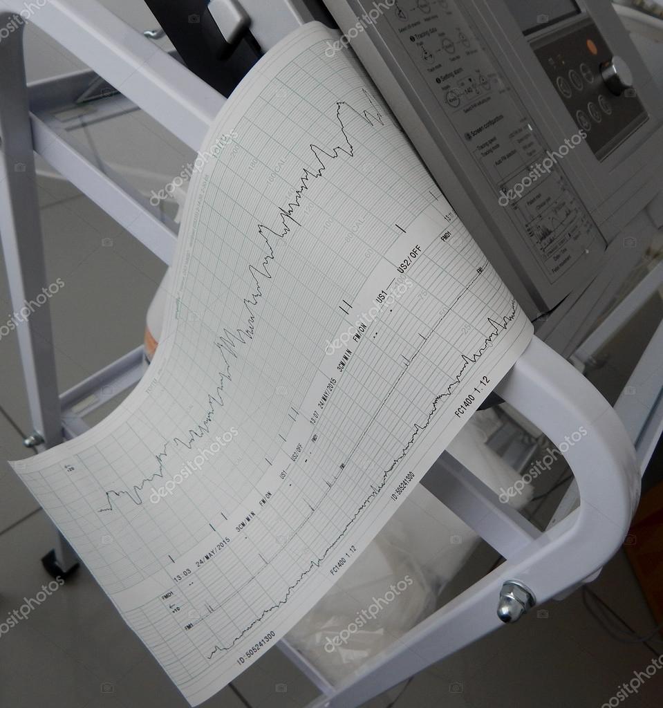 Cardiograph fixing and printing graphs of heart rate — Stock Photo ...