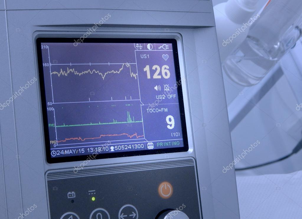 Cardiograph fixing and printing graphs of heart rate — Stock Photo ...