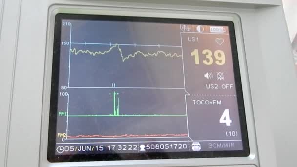 160 Frequência cardíaca normal Stock Videos, 4K & HD Footage ...
