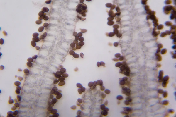 Microscope fungi Stock Photos, Royalty Free Microscope fungi Images ...