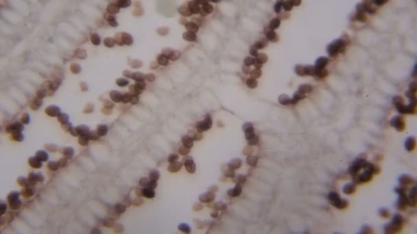 Anodonta gills ciliated epithelium under the microscope - Abstract pink ...